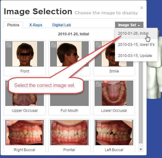Design the Smile Line with the Lip Trace Line Tool